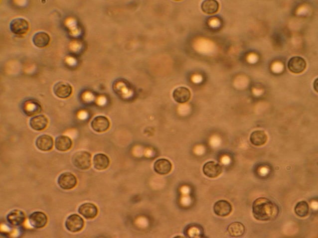 Microscopic examination of urine | PPTX