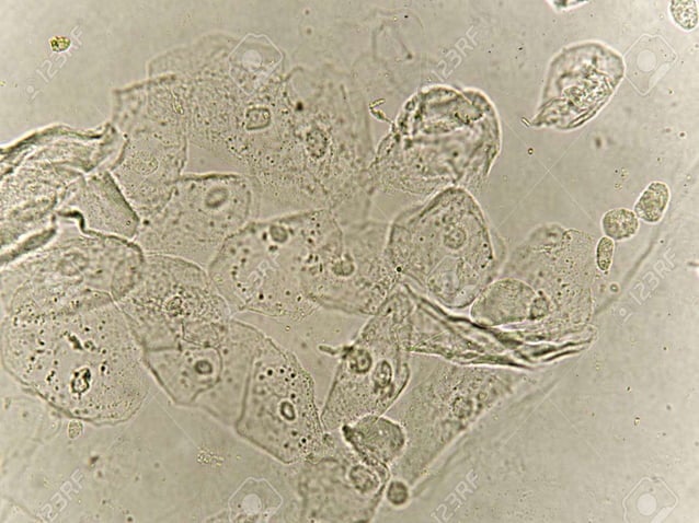 Microscopic examination of urine | PPTX