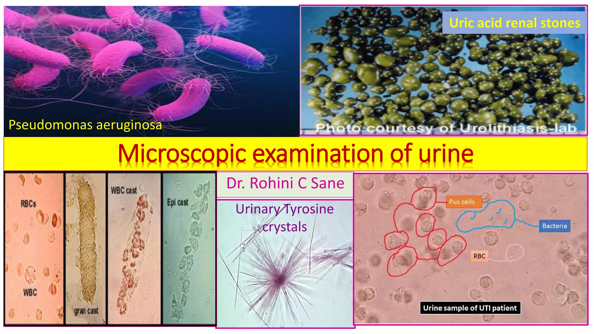 Microscopic examination of urine | PDF