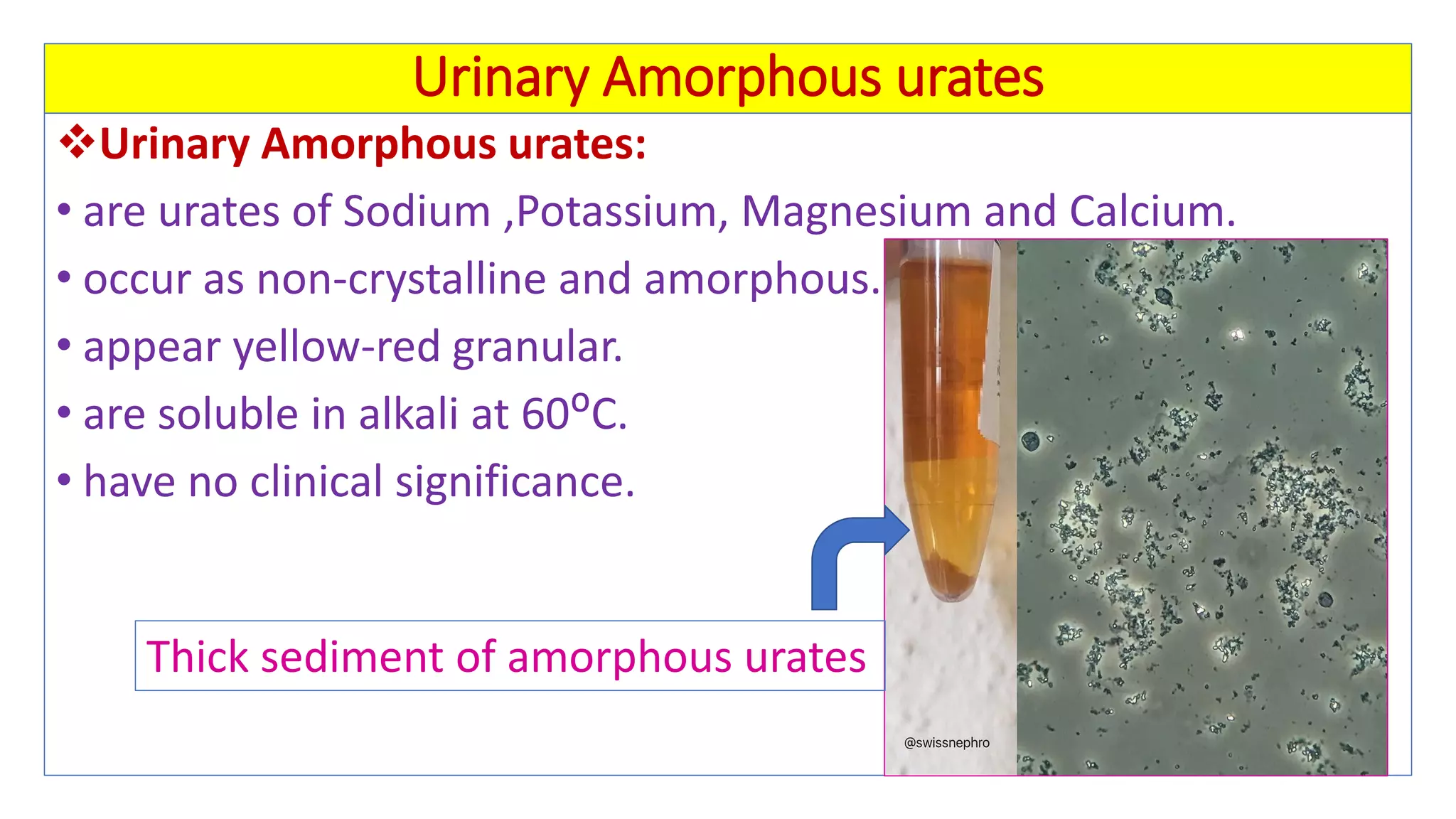 Microscopic examination of urine | PDF