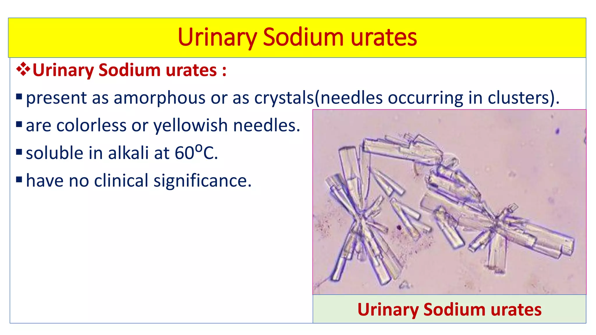 Microscopic examination of urine | PDF