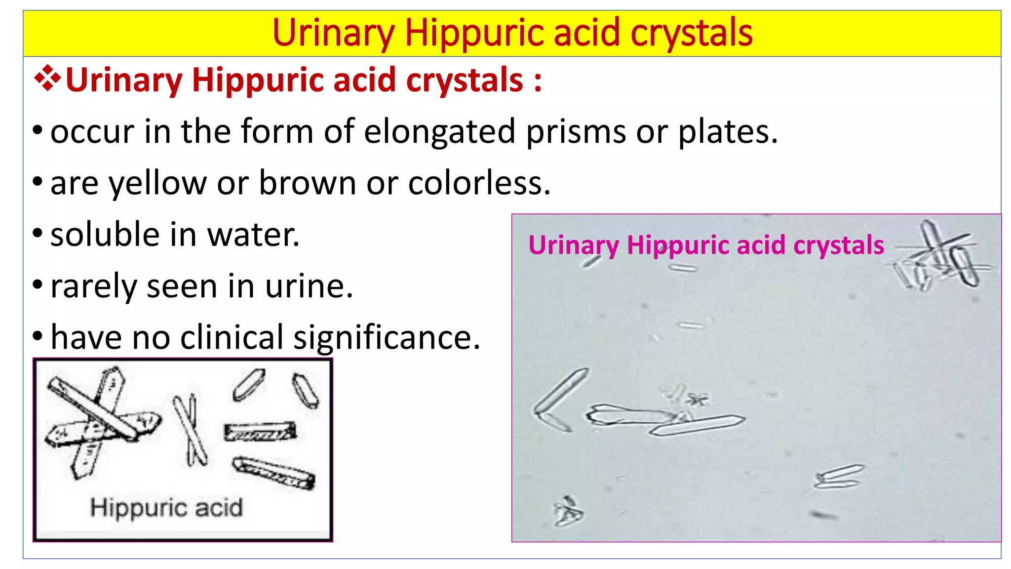 Microscopic examination of urine | PDF