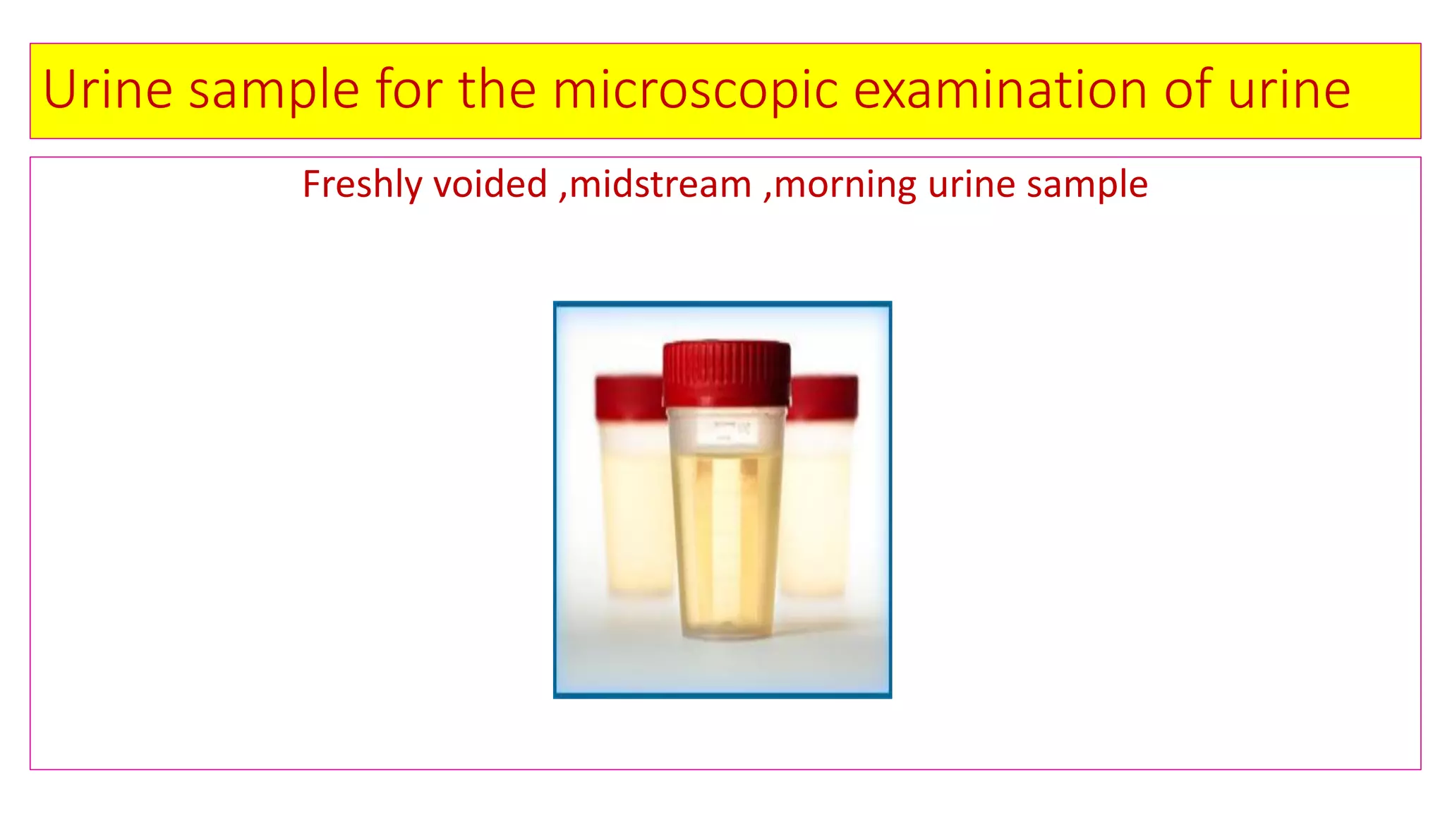 Microscopic examination of urine | PDF