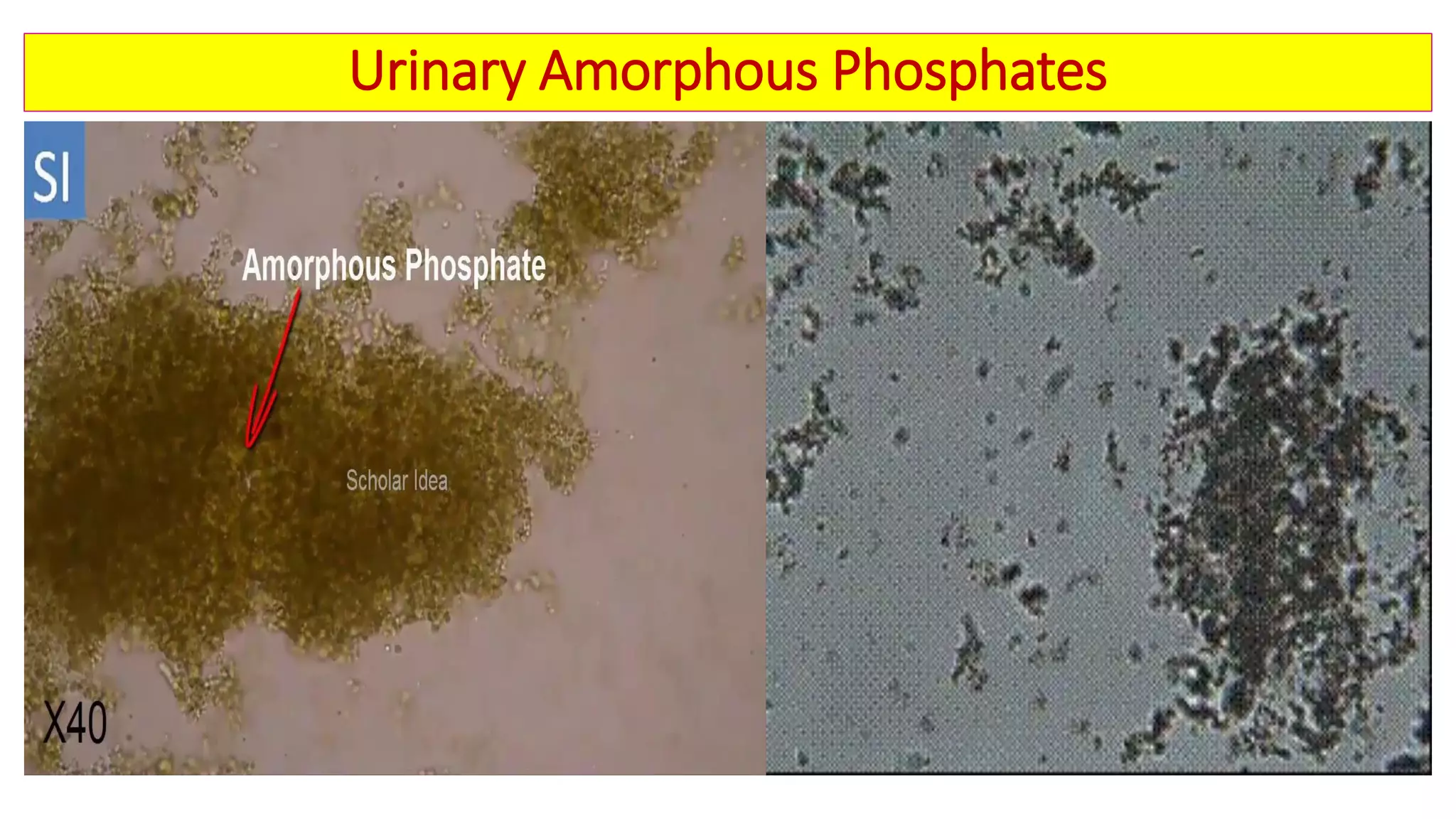 Microscopic examination of urine | PDF