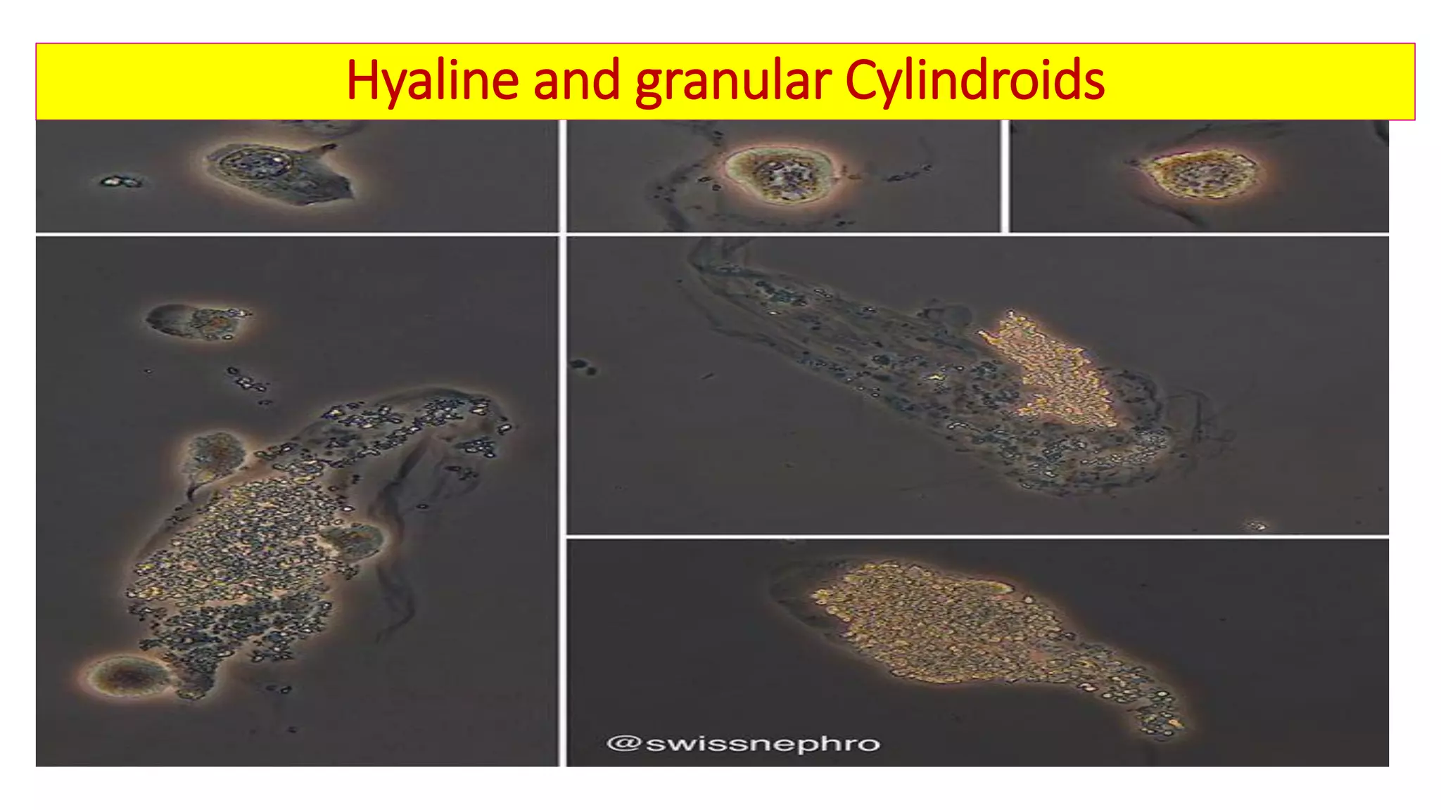 Microscopic examination of urine | PDF