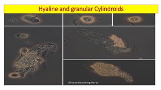 Microscopic examination of urine | PDF
