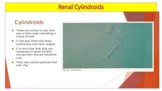 Microscopic examination of urine | PDF