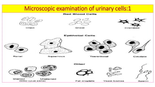 Microscopic examination of urine | PDF