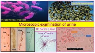 Microscopic Bacteria In Urine