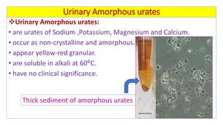 Amorphous Urates In Urine