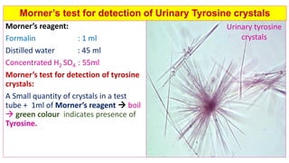 Tyrosine Crystals In Urine