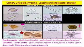 Tyrosine In Urine