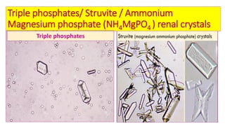 Magnesium Phosphate Crystals