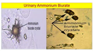 Ammonium Biurate
