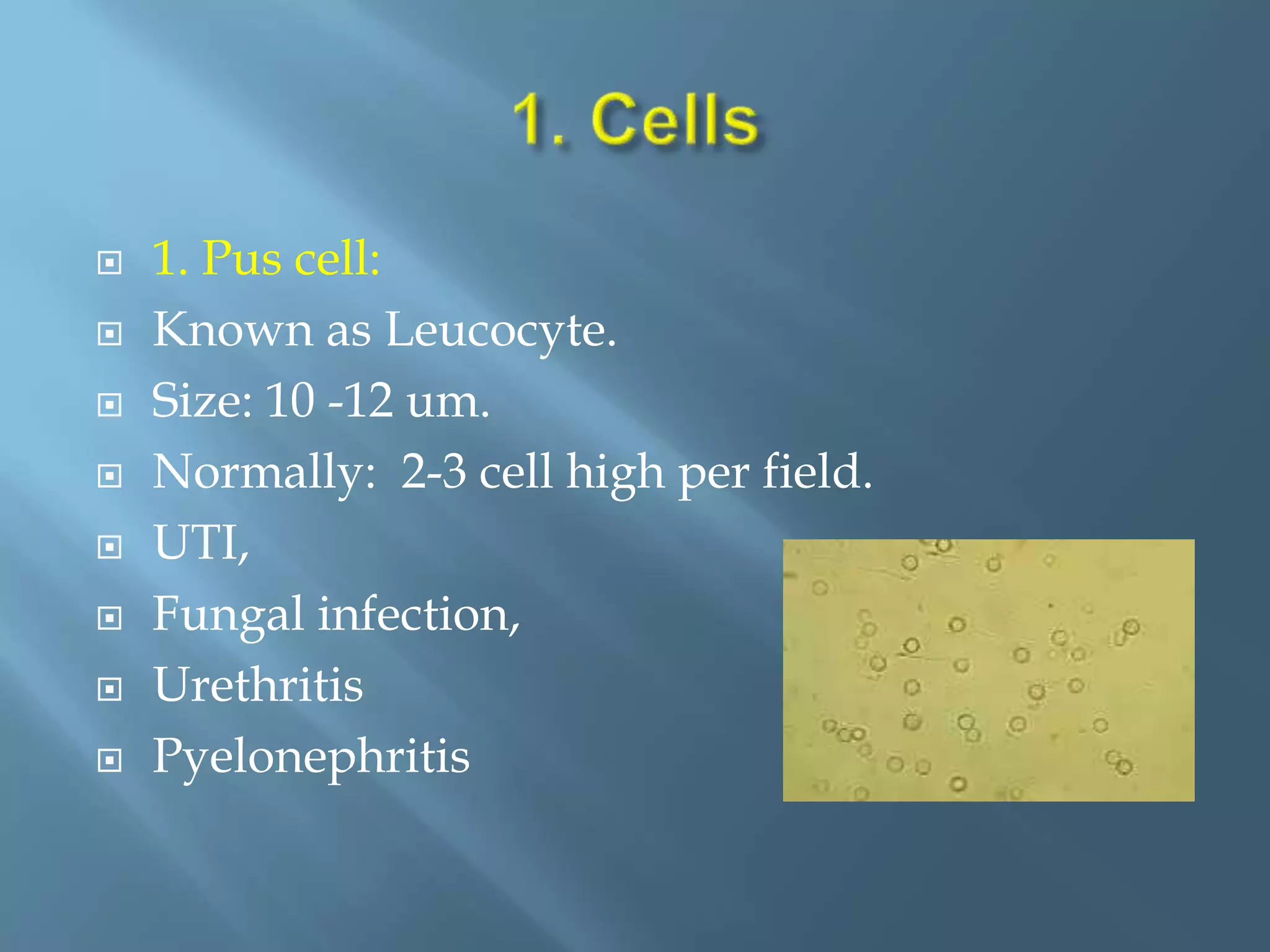Microscopic examination of urine | PPTX