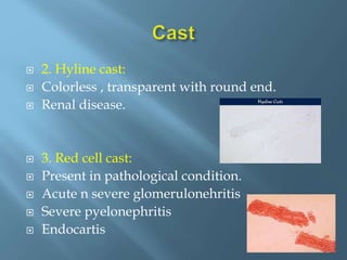 Microscopic examination of urine | PPTX