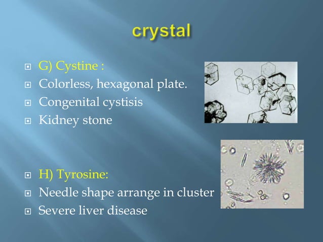 Microscopic examination of urine | PPT
