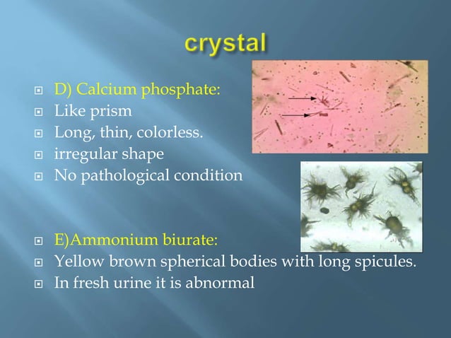 Microscopic examination of urine | PPTX | Blood Disorders | Diseases ...