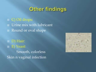 Microscopic examination of urine | PPTX