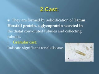 Microscopic examination of urine | PPTX