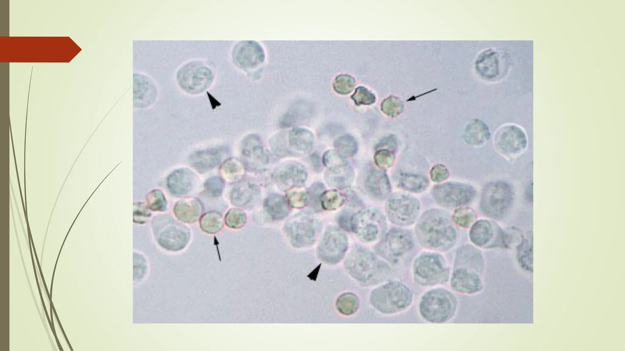 Microscopic_Examination_of_Urine_pdf.pdf