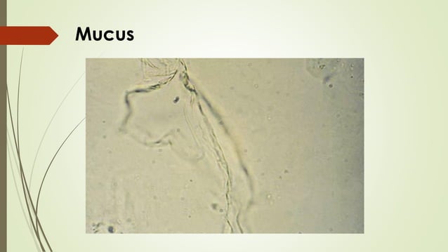 Microscopic_Examination_of_Urine_pdf.pdf