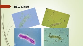 Microscopic_Examination_of_Urine_pdf.pdf