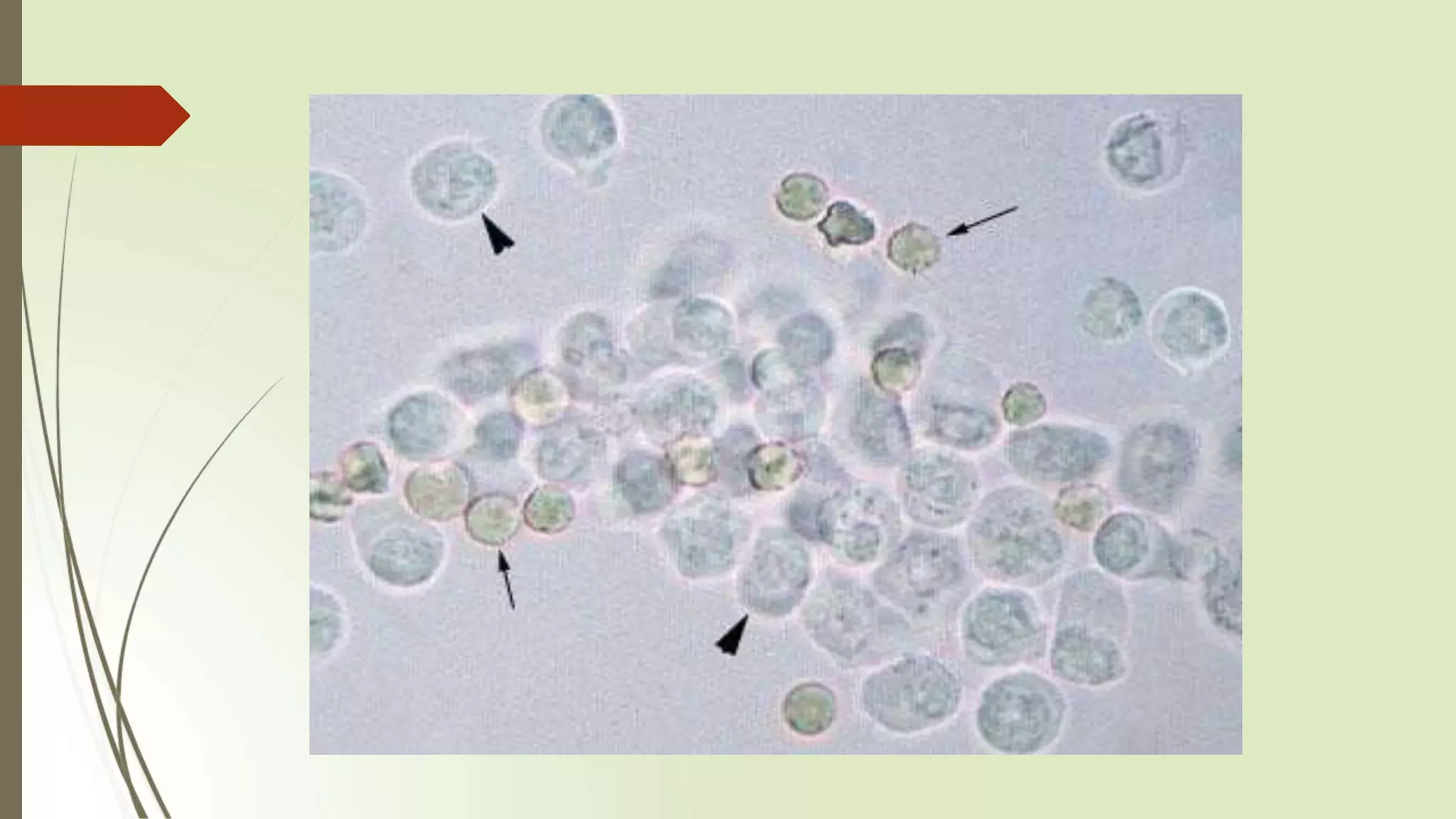 Microscopic_Examination_of_Urine_pdf (1).pptx