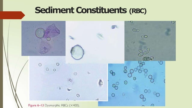 Microscopic_Examination_of_Urine_pdf (1).pptx | Chemistry | Science