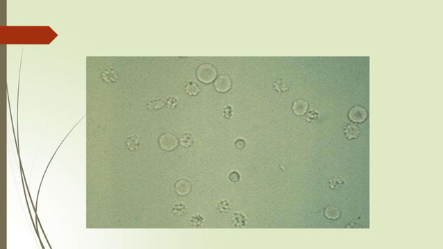 Microscopic_Examination_of_Urine_pdf (1).pptx | Chemistry | Science
