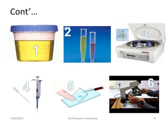 Microscopic examination of Urine sediments.ppt | Geology | Science