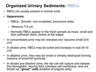 Microscopic examination of Urine sediments.ppt