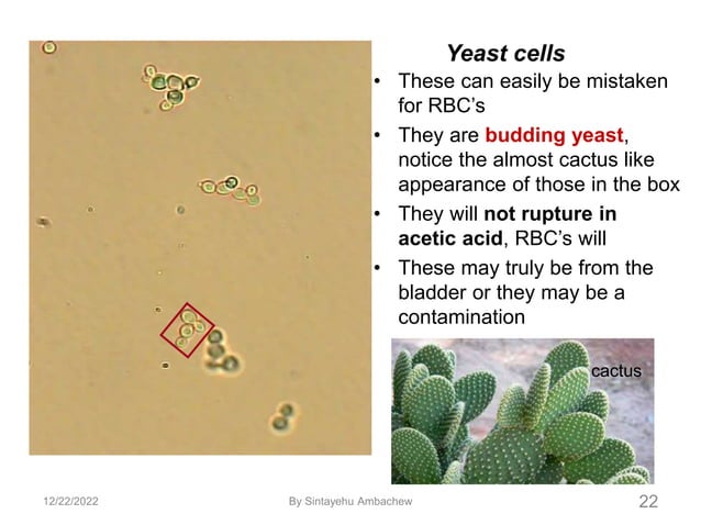 Microscopic examination of Urine sediments.ppt | Geology | Science