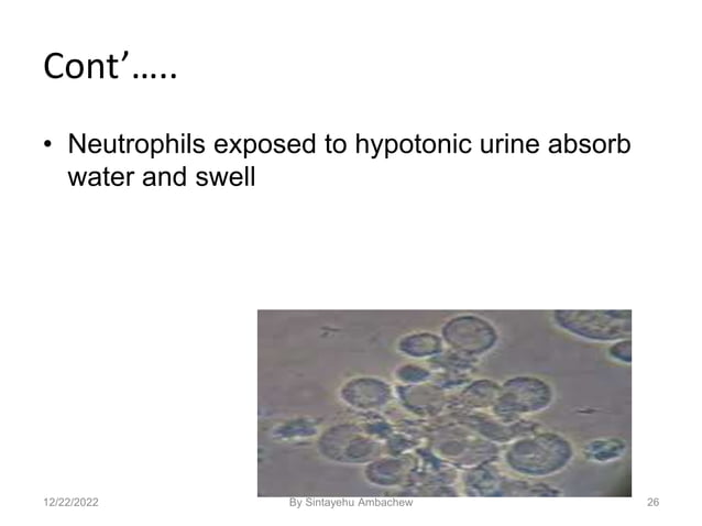 Microscopic examination of Urine sediments.ppt | Geology | Science