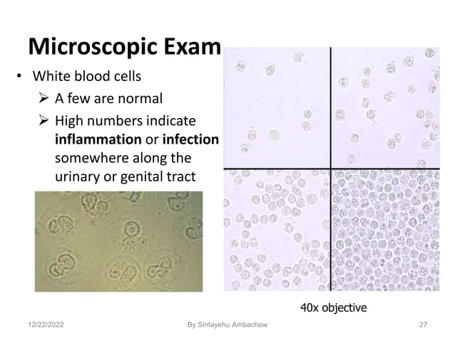 Microscopic examination of Urine sediments.ppt | Geology | Science