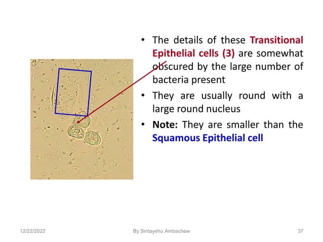 Microscopic examination of Urine sediments.ppt | Geology | Science