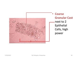 Microscopic examination of Urine sediments.ppt | Geology | Science