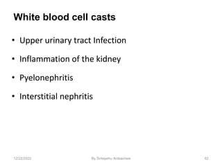 Microscopic examination of Urine sediments.ppt