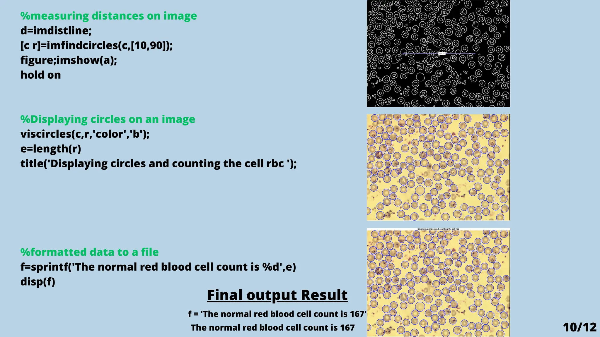 Microscopic Image Analysis for Cell Counting using MATLAB.pdf