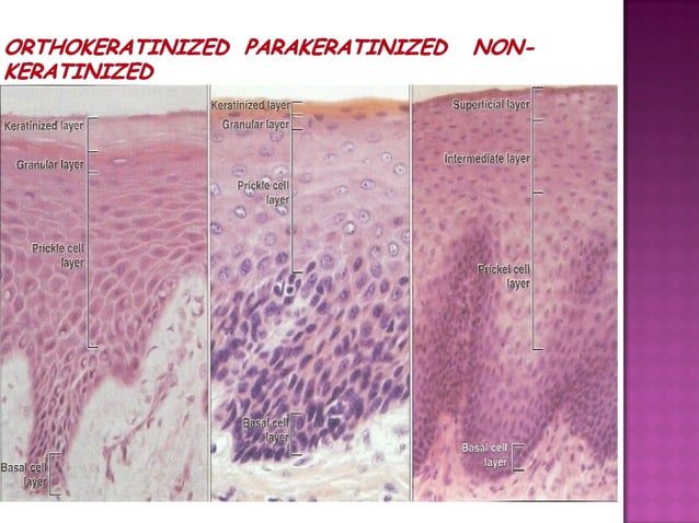 Microscopic features of gingiva | PPT