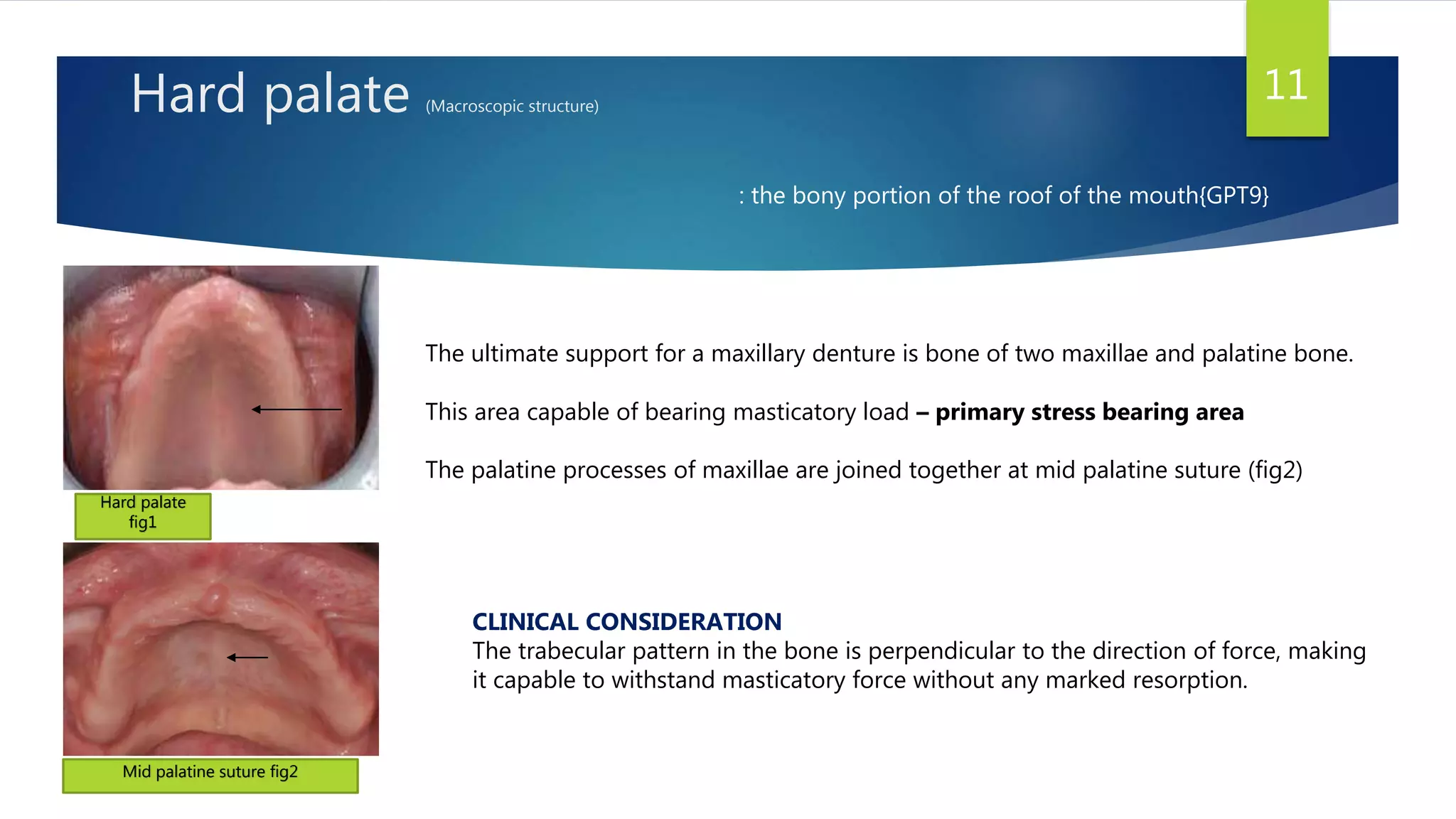 Anatomical landmarks of maxilla and mandible | PPTX