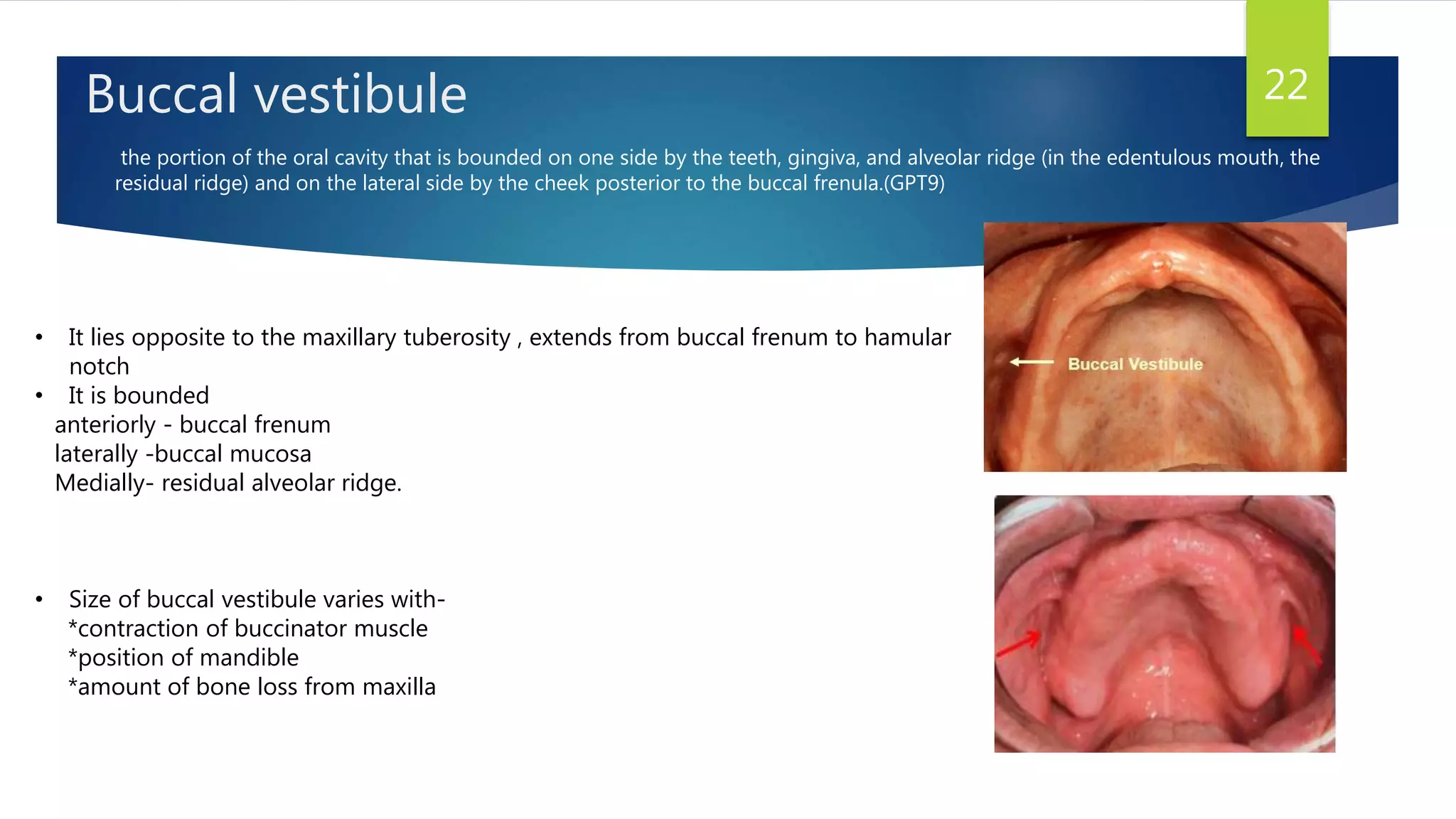 Anatomical landmarks of maxilla and mandible | PPTX