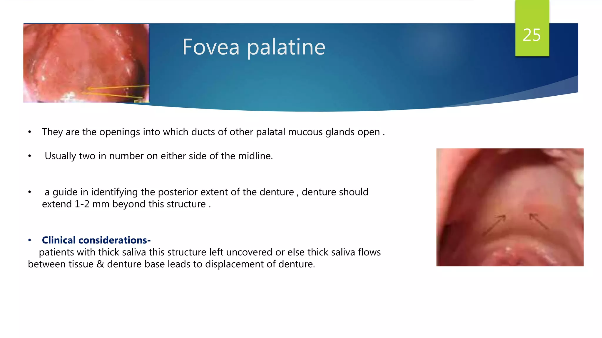 Anatomical landmarks of maxilla and mandible | PPTX