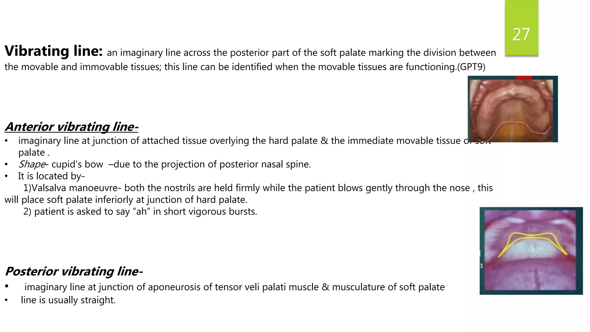 Anatomical landmarks of maxilla and mandible | PPTX