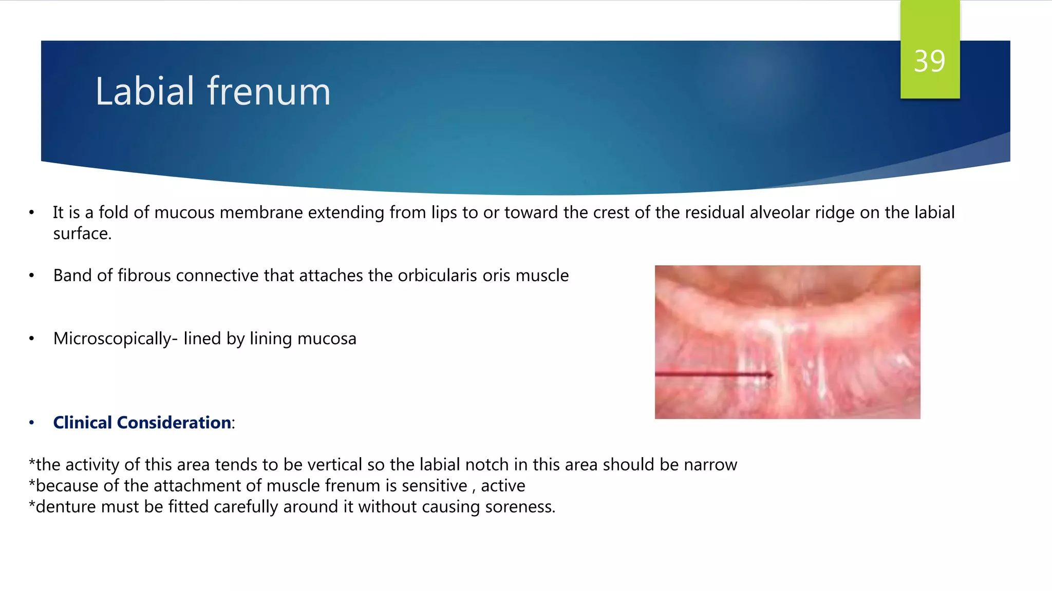 Anatomical landmarks of maxilla and mandible | PPTX