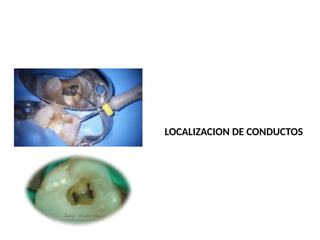 MICROSCOPIO (cirugías apicales o endodonticas) | PPTX