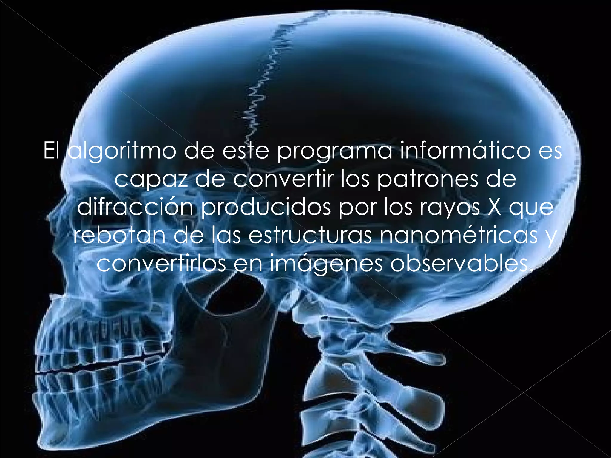 Microscopio de rayos x | PPT | Physics | Science