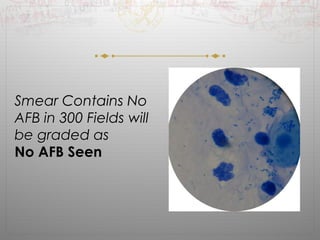 Microscopy smear examination 2014 | PPT
