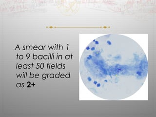 Microscopy smear examination 2014 | PPT