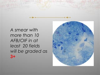 Microscopy smear examination 2014 | PPT